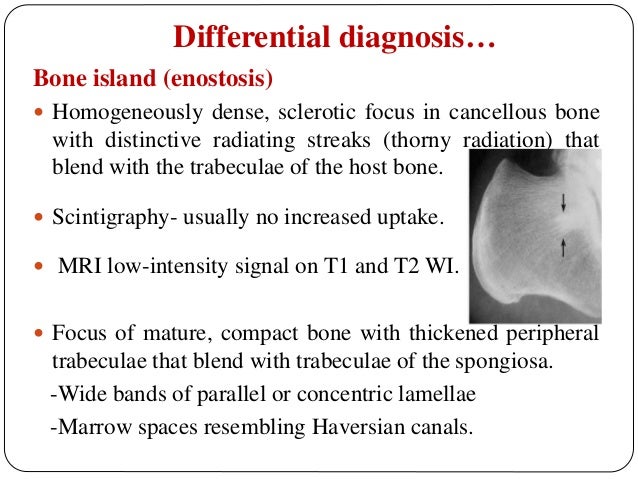 Bone forming tumors rabins