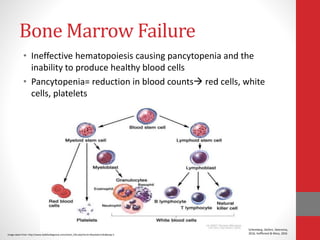 Bone-Marrow-Failure-Diseases-Sept-18-2018 - Copy.pptx