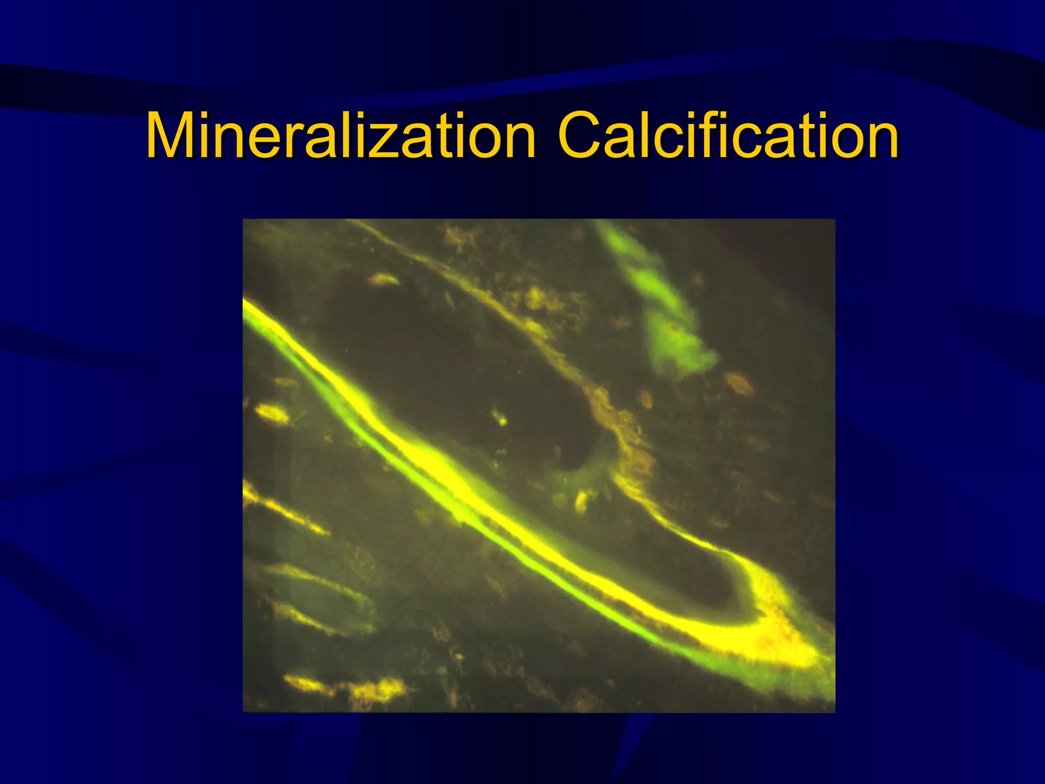 Bone Metabolism Ortho New | PPT