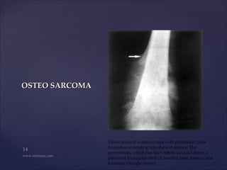 bone-tumors cartilaginous and bone cells.pdf