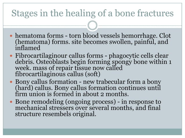 Bone Fractures | PPT