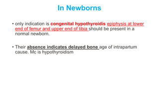 Bone age assessent | PPTX