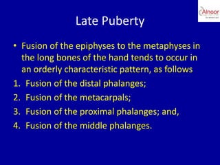 Bone age assessment | PPTX