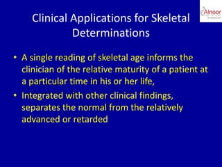 Bone age assessment | PPTX