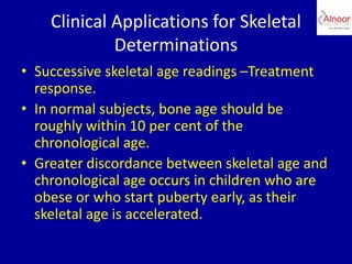 Bone age assessment | PPTX