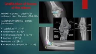 Bone age determination by assessment of skeletal maturity.pptx