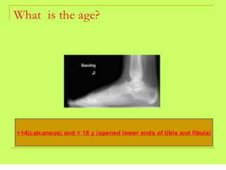Bone age estimation | PPT