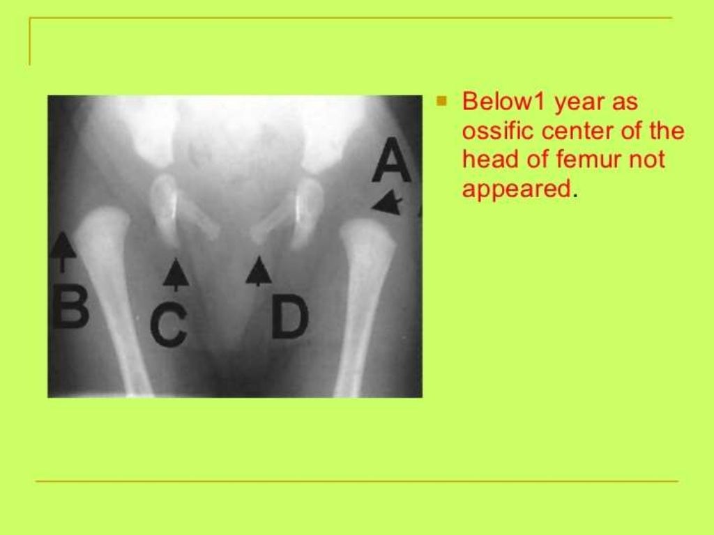 Ossification Test