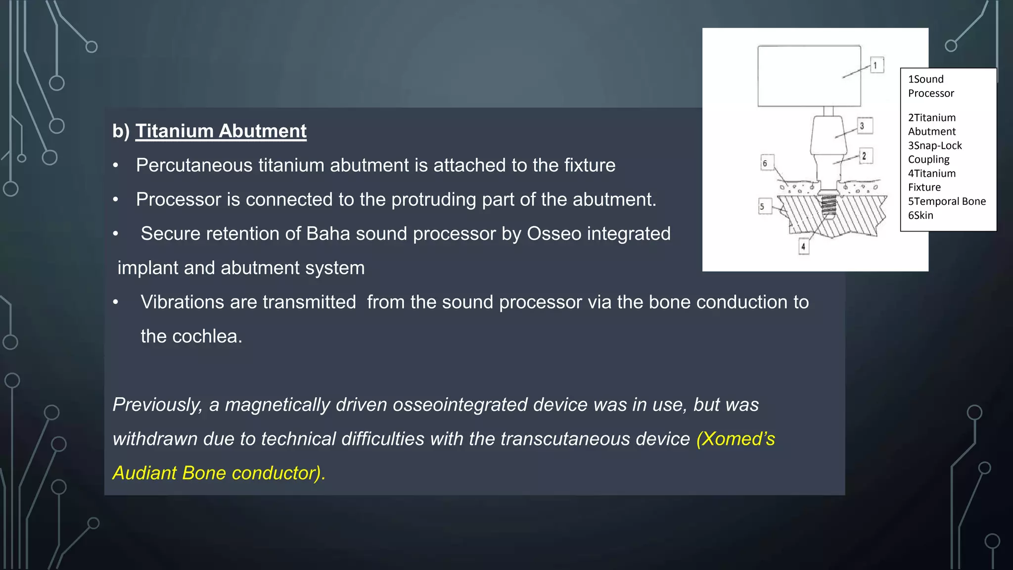 Bone Anchored Hearing Aids (BAHA).pptx