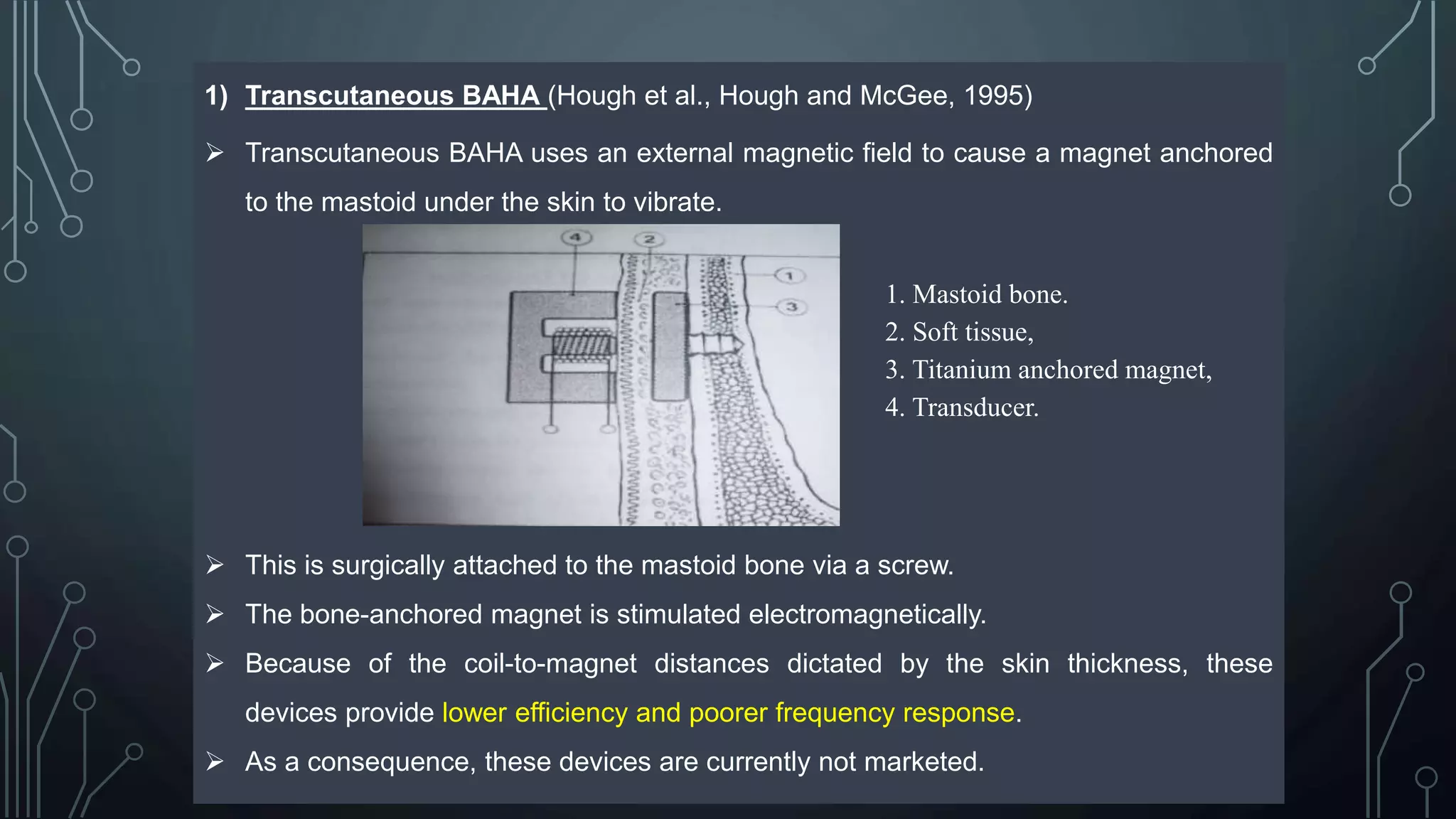 Bone Anchored Hearing Aids (BAHA).pptx