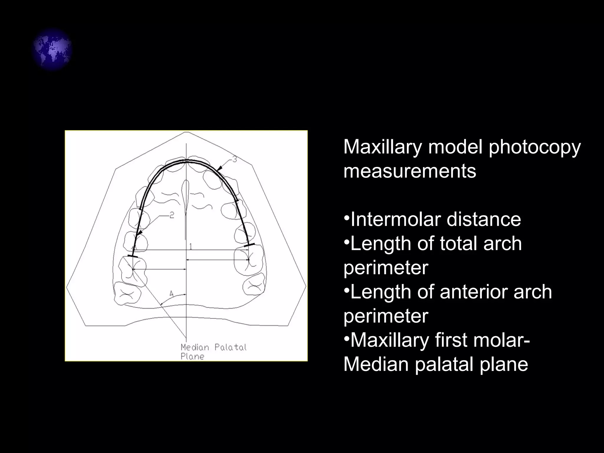 Bone anchored pendulum appliance. (2) | PPT