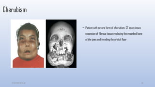 Anatomy development and histology of Bone and Alveolar Bone.pptx