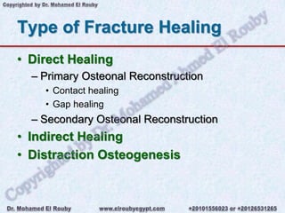 Bone and cartilage healing | PPT