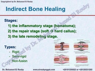 Bone and cartilage healing | PPTX