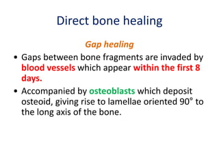 Bone and fracture healing | PPTX