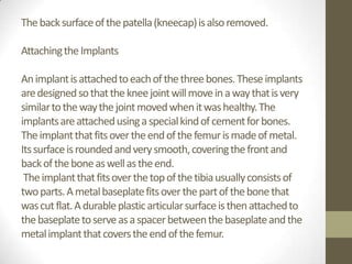 Bone and joint care | PPT