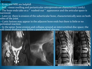 Bone and joint infection | PPTX
