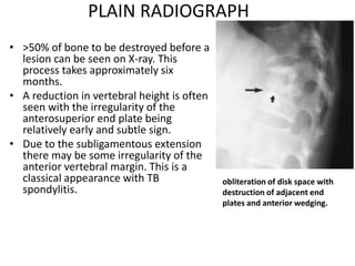Bone and joint infection presentation | PPTX