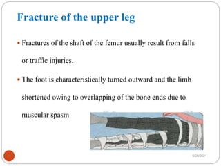 Bone and joint injuries.pptx for pharmacy | PPTX