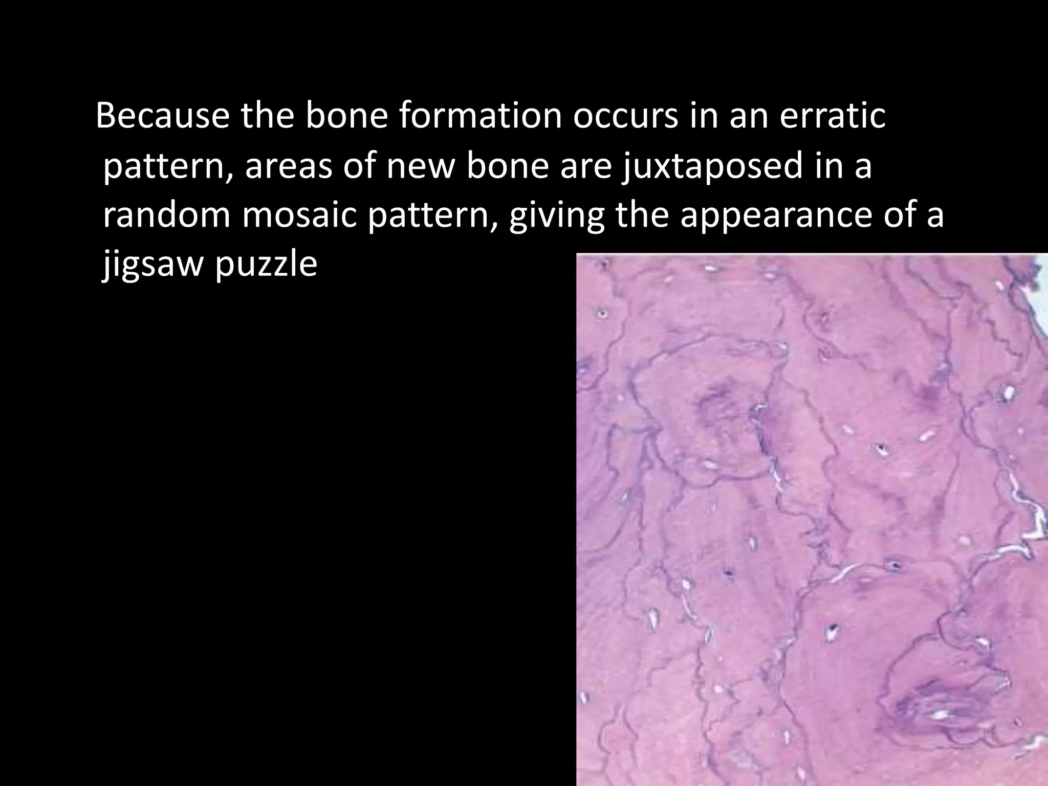 bone and soft tissue.ppt