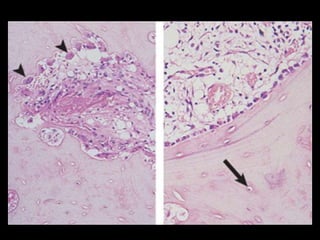 bone and soft tissue.ppt
