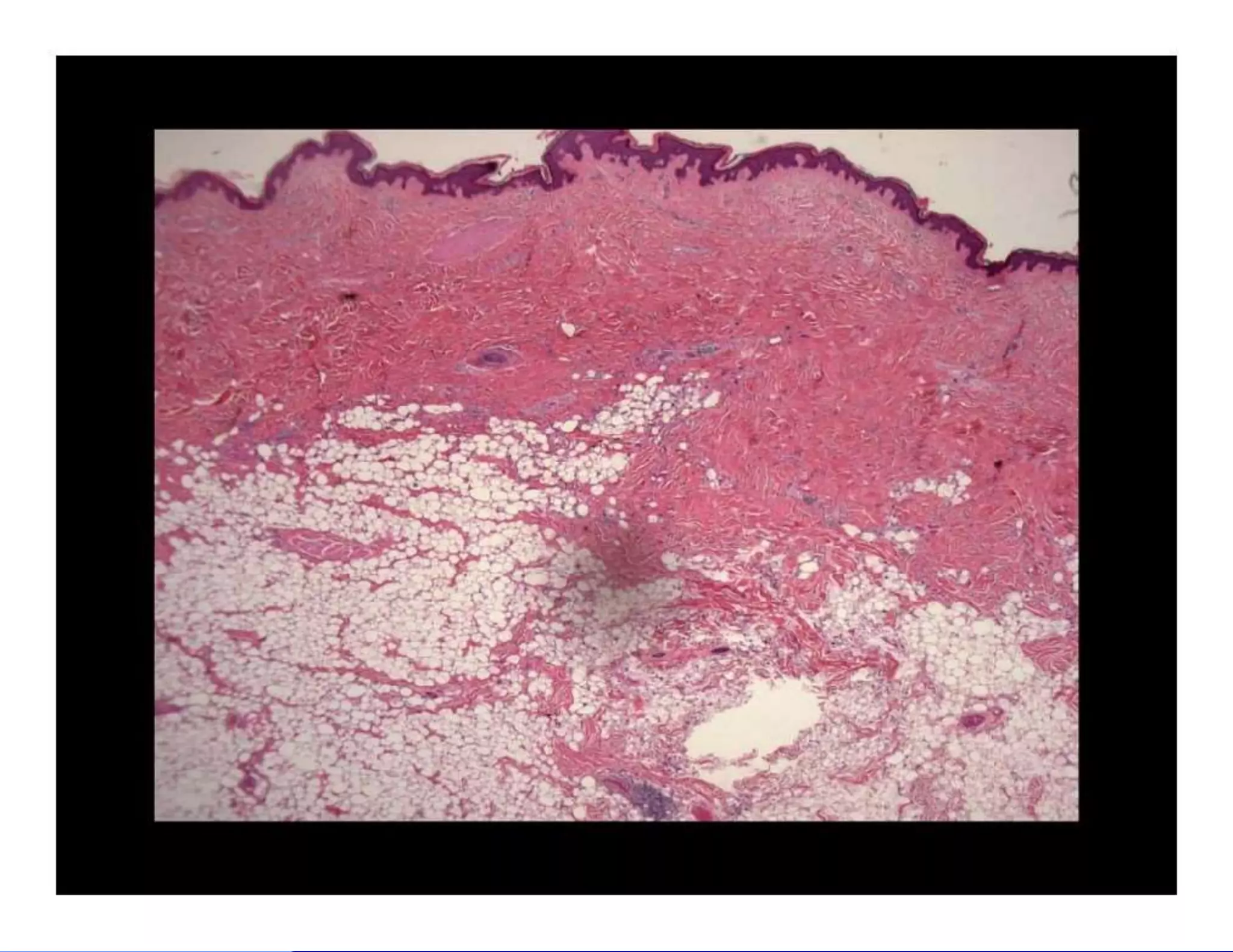 Bone and soft tissue pathology | PPTX