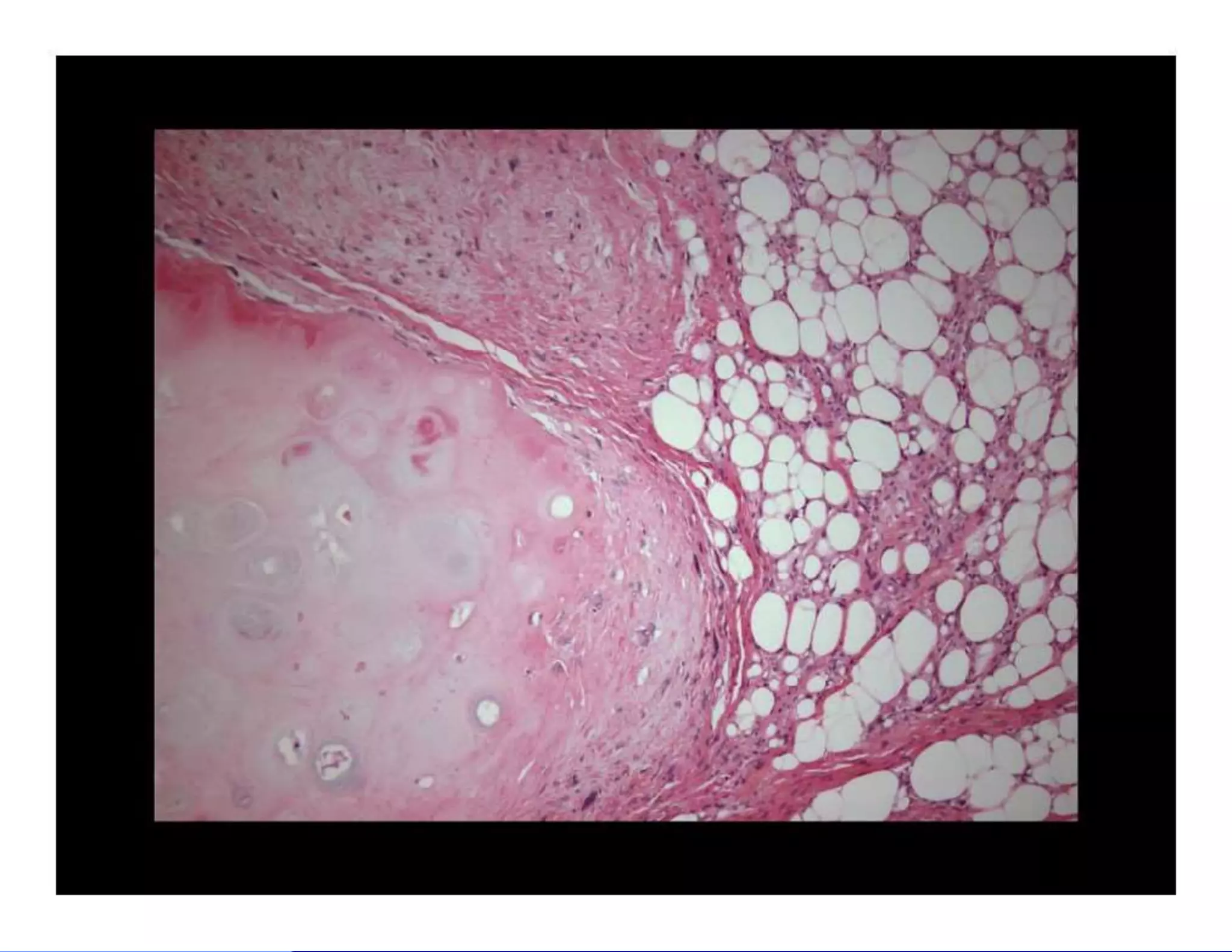 Bone and soft tissue pathology | PPTX