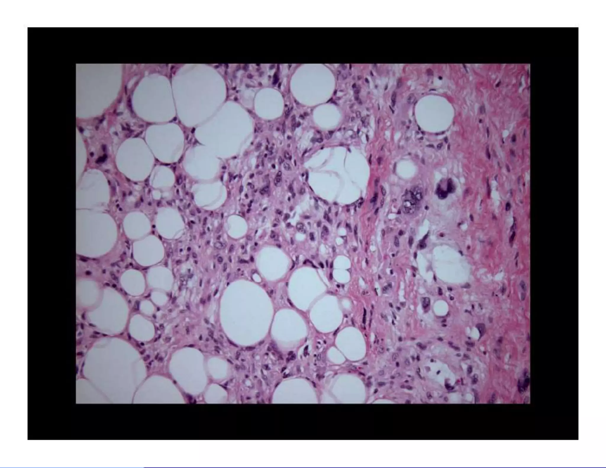 Bone and soft tissue pathology | PPTX