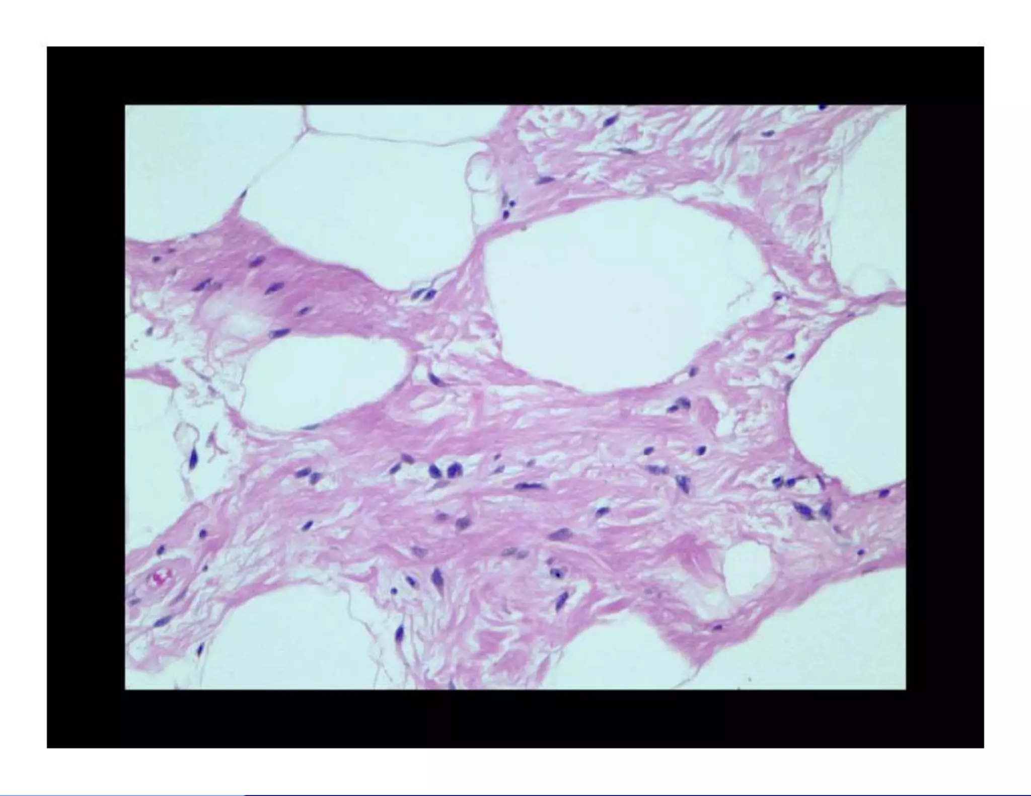 Bone and soft tissue pathology | PPTX