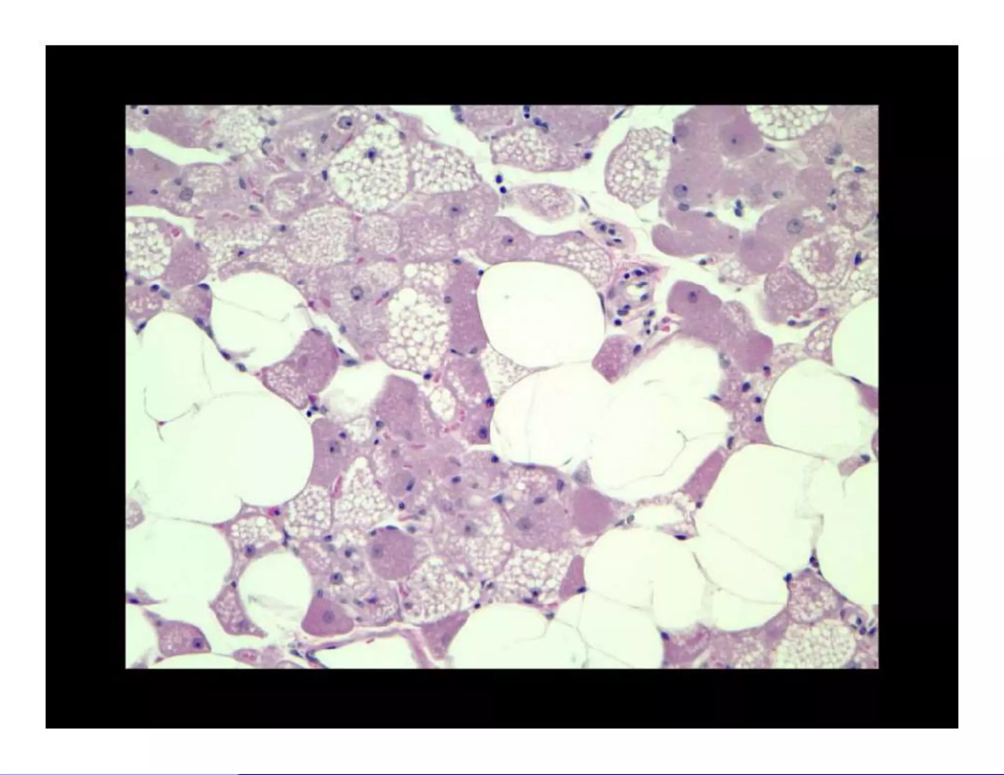 Bone and soft tissue pathology | PPTX