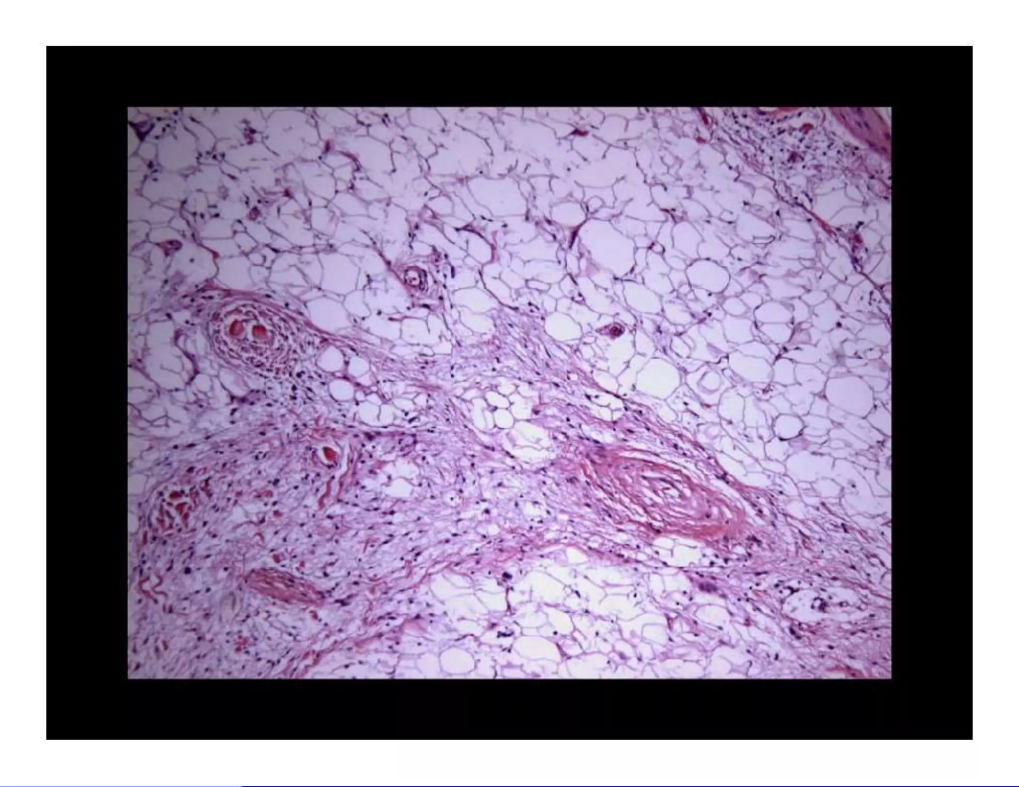 Bone and soft tissue pathology | PPTX
