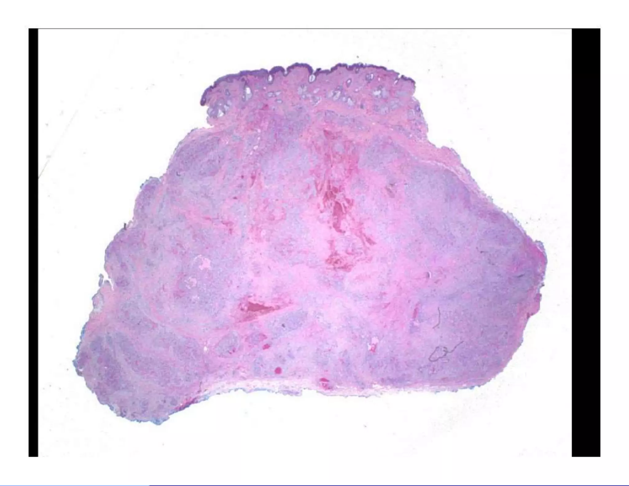 Bone and soft tissue pathology | PPTX