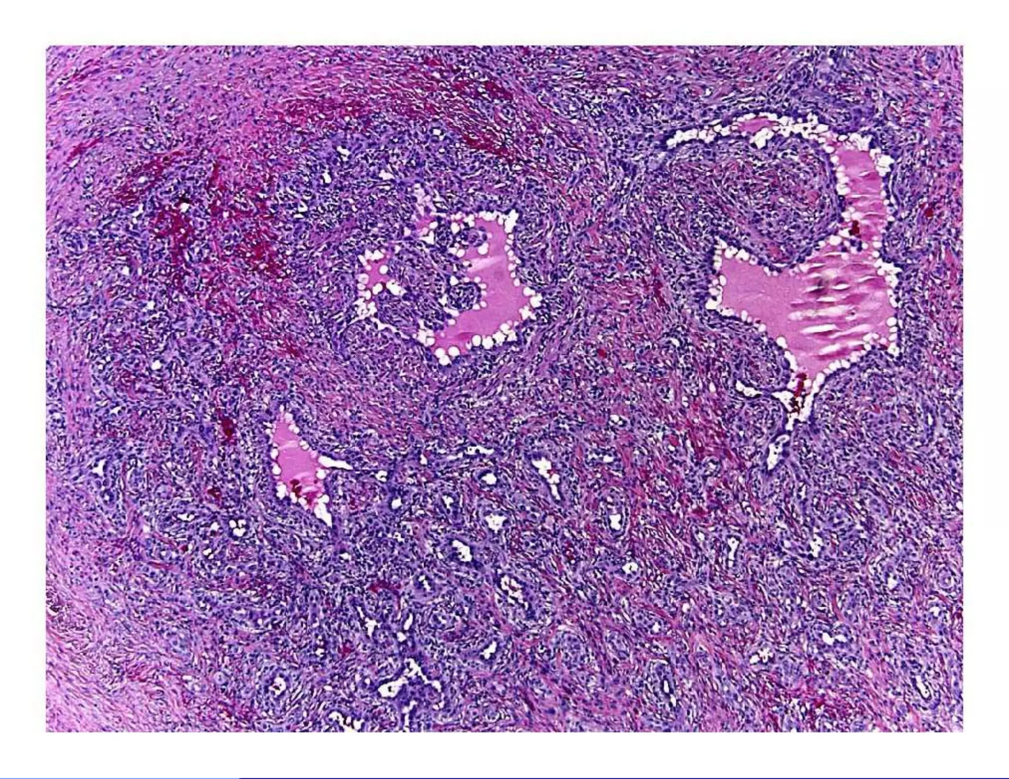 Bone and soft tissue pathology | PPTX