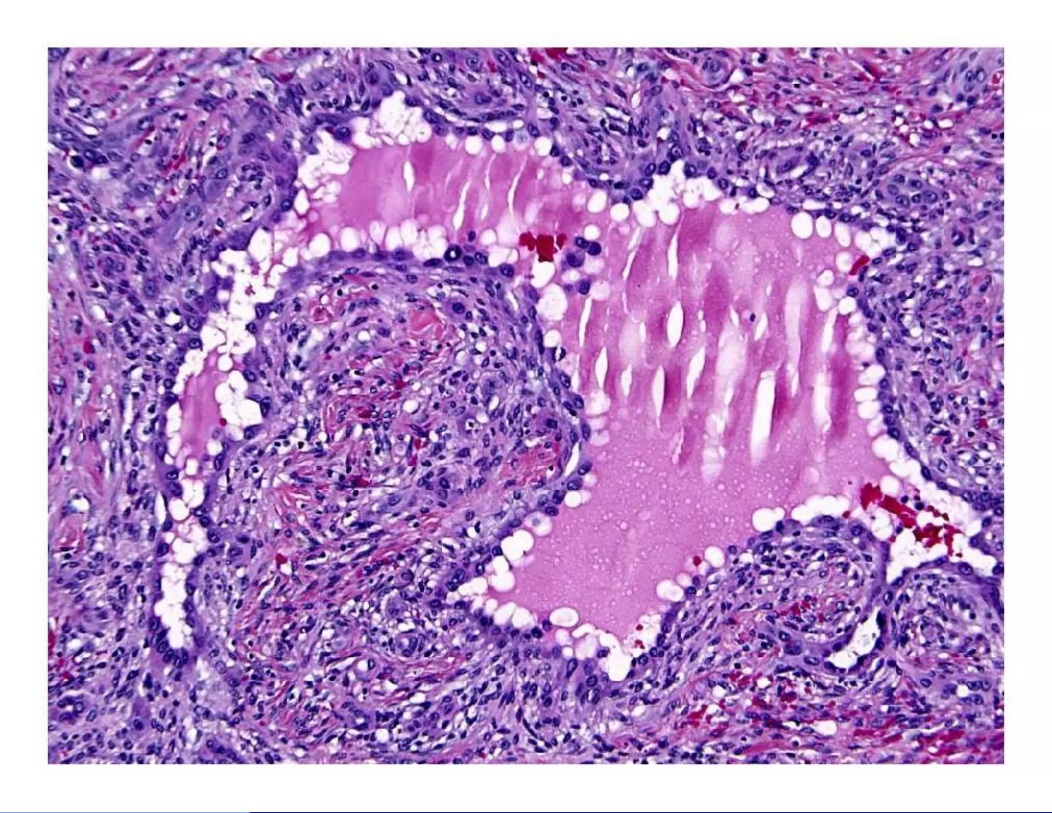 Bone and soft tissue pathology | PPTX