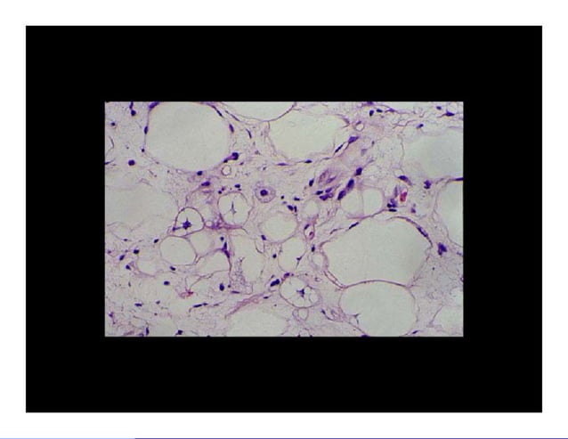 Bone and soft tissue pathology | PPTX