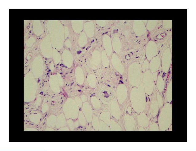 Bone and soft tissue pathology | PPTX