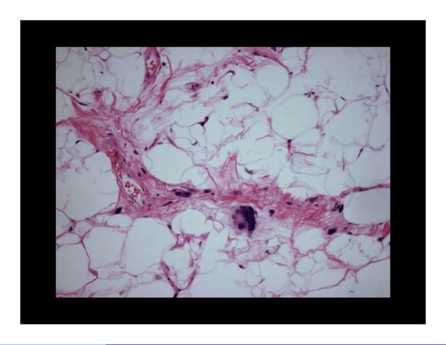 Bone and soft tissue pathology | PPTX