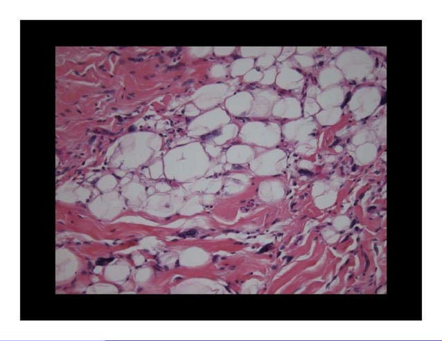 Bone and soft tissue pathology | PPTX