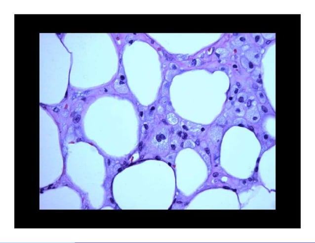 Bone and soft tissue pathology | PPTX