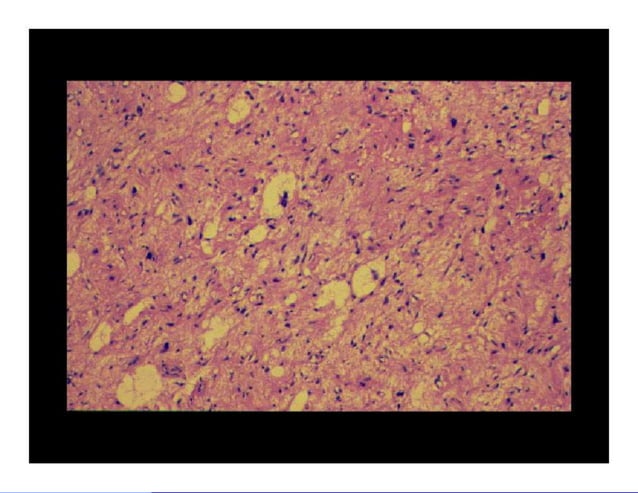 Bone and soft tissue pathology | PPTX