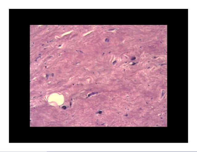 Bone and soft tissue pathology | PPTX