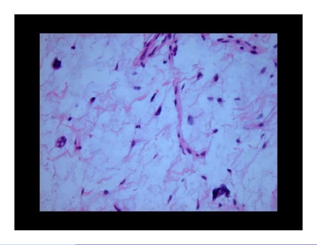 Bone and soft tissue pathology | PPTX