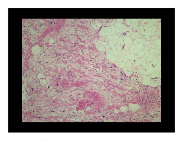 Bone and soft tissue pathology | PPTX