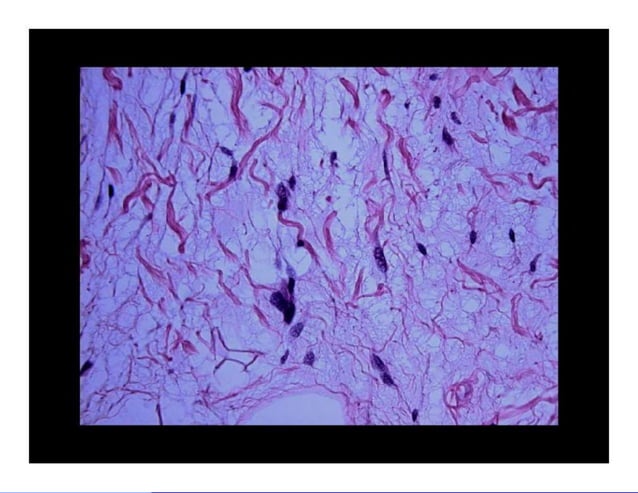 Bone and soft tissue pathology | PPTX