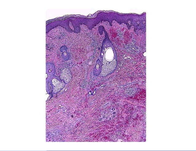 Bone and soft tissue pathology | PPTX