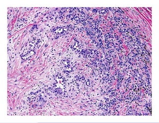 Bone and soft tissue pathology | PPTX
