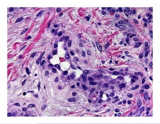 Bone and soft tissue pathology | PPTX