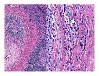 Bone and soft tissue pathology | PPTX
