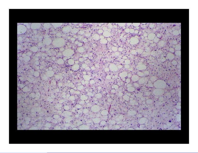 Bone and soft tissue pathology | PPTX