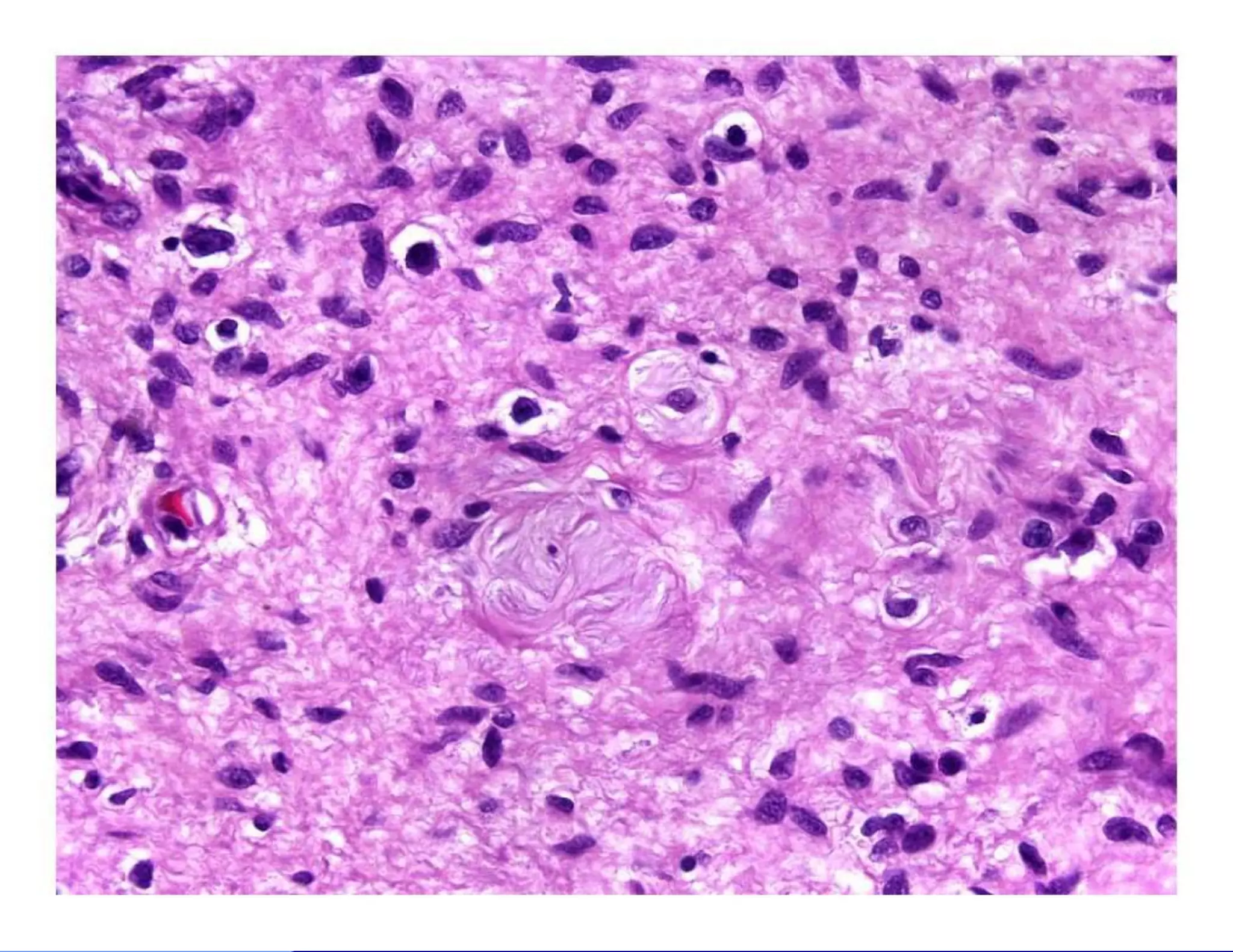 Bone and soft tissue pathology | PPT